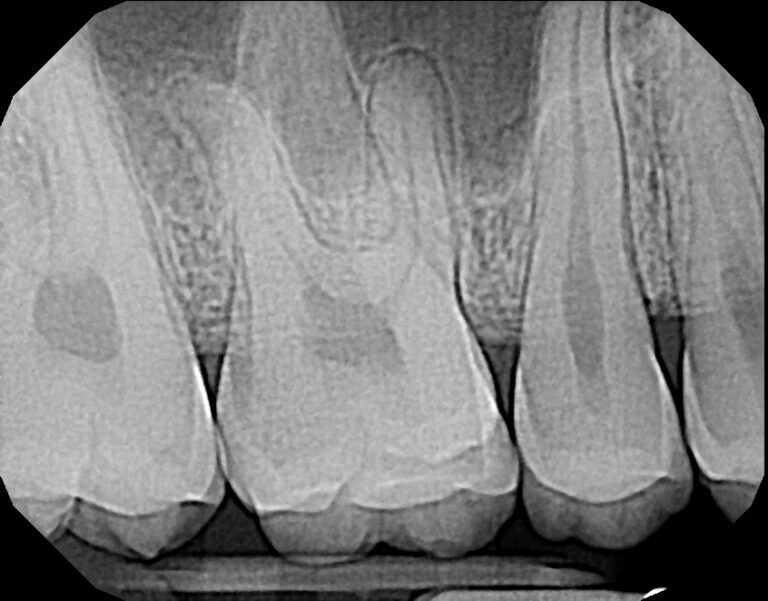 DentiMax vs. Dexis Comprehensive 1-on-1 - DentiMax