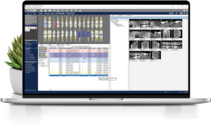 DentiMax: Dental Sensors & Software For Your Practice
