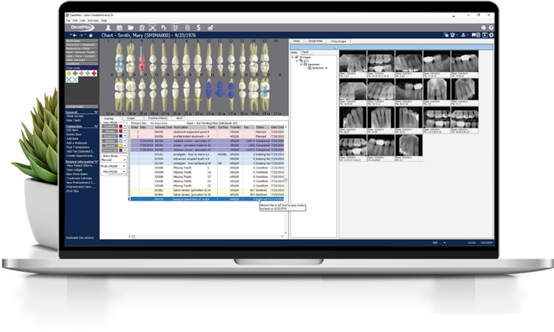 Cloud-Based Dental Practice Management Software - DentiMax
