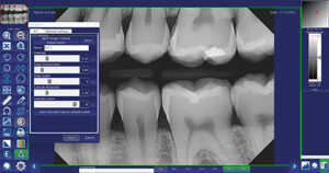 Dental Imaging Software for X-Rays - DentiMax
