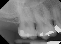 Open Sensor - Affordable Digital X-Ray Sensor | DentiMax