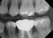Open Sensor - Affordable Digital X-Ray Sensor | DentiMax
