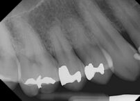 Open Sensor - Affordable Digital X-Ray Sensor | DentiMax
