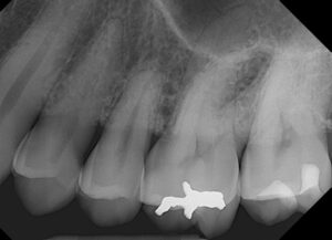 Open Sensor - Affordable Digital X-Ray Sensor | DentiMax