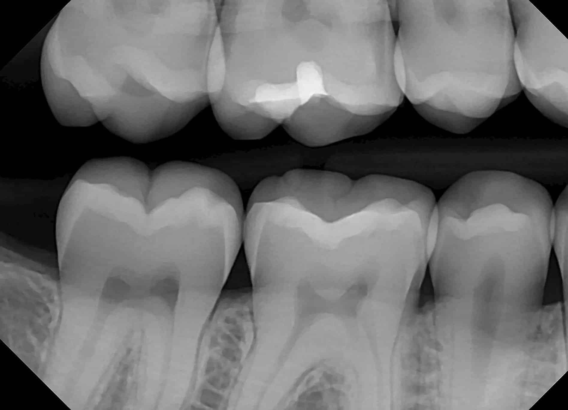 Dream Sensor - Award-Winning Digital X-Ray Sensor | DentiMax